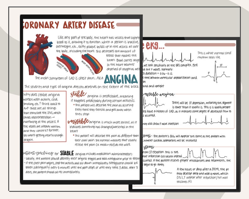 Coronary Artery Disease, Myocardial Infarction Nursing Notes // Digital ...