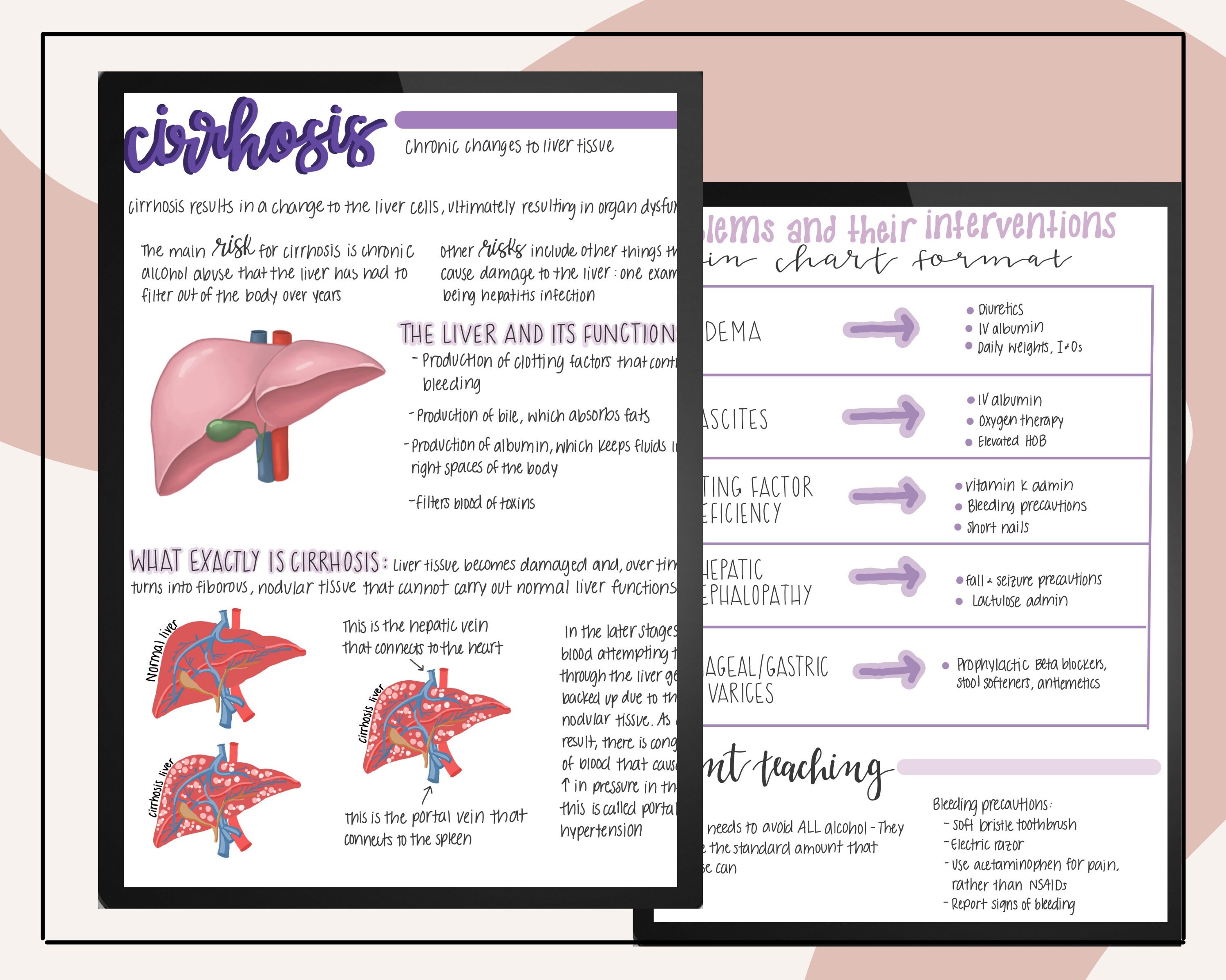 Cirrhosis Nursing Notes // Digital Download // Goodnotes File & PDF - Etsy