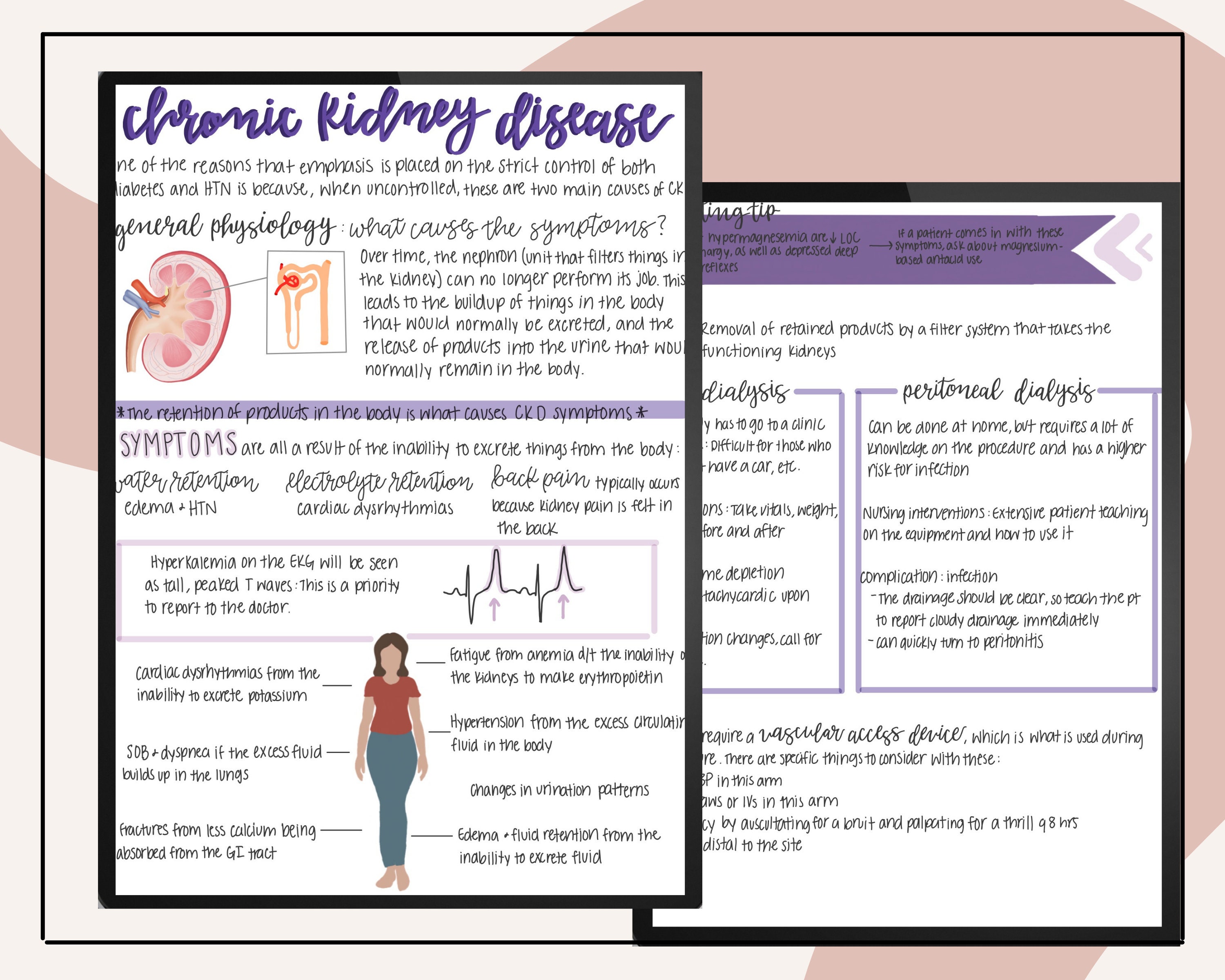 Chronic Kidney Disease Nursing Notes // Digital Download // Goodnotes ...
