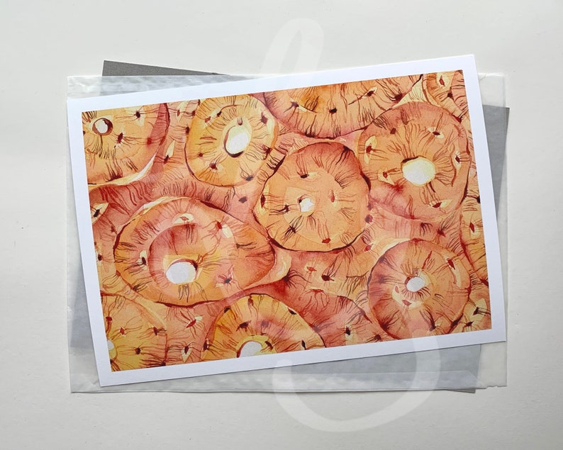 Histology Art Print: Bone Thionin&schmorl Stain Watercolor | Etsy