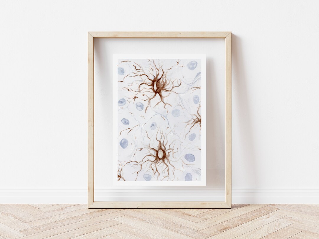 Neuropathology Series: Tufted Astrocytes – Watercolor Art Print - Etsy