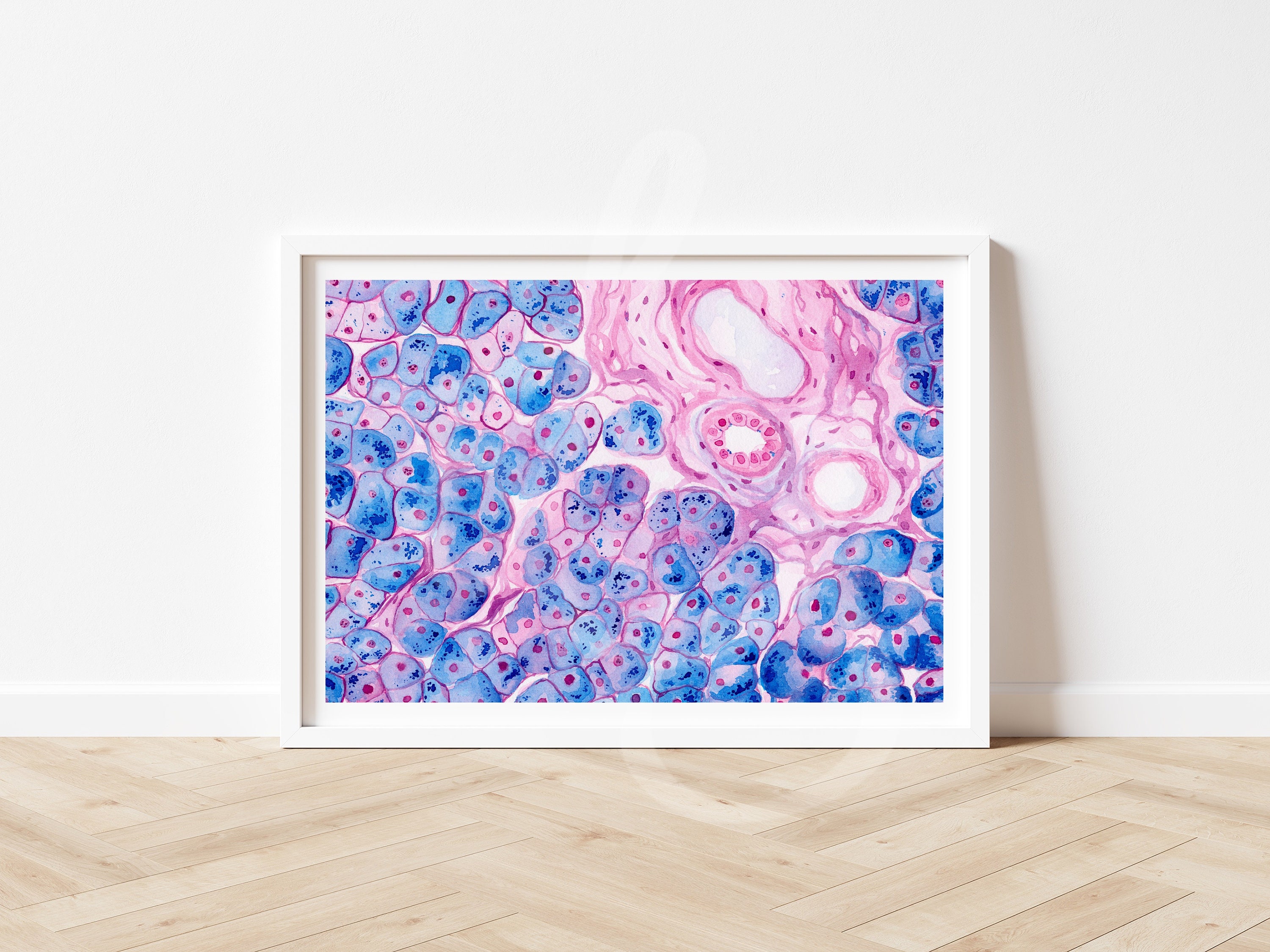 Prussian Blue Stain Brain