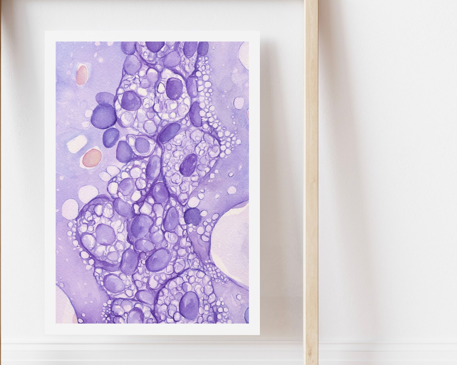 Veterinary Cytology Series: Sebaceous Adenoma Dog - Etsy