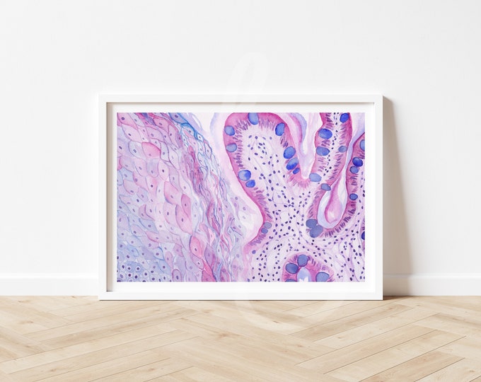 Pathology Art Print: Barretts Oesophagus, AB/PAS - Etsy