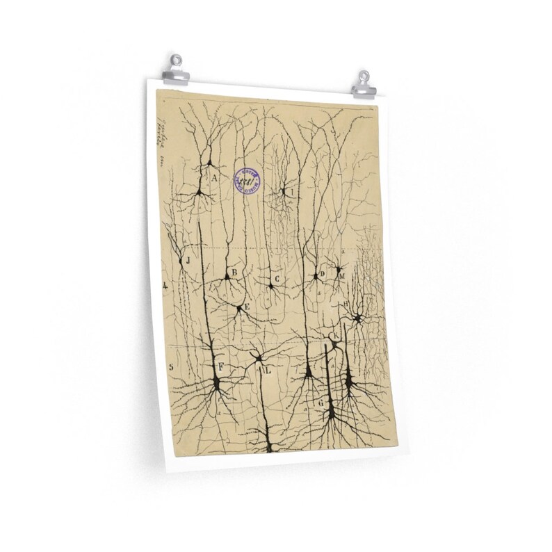 Neuron Drawing by Ramon Santiago Antique Brain Anatomy Art - Etsy