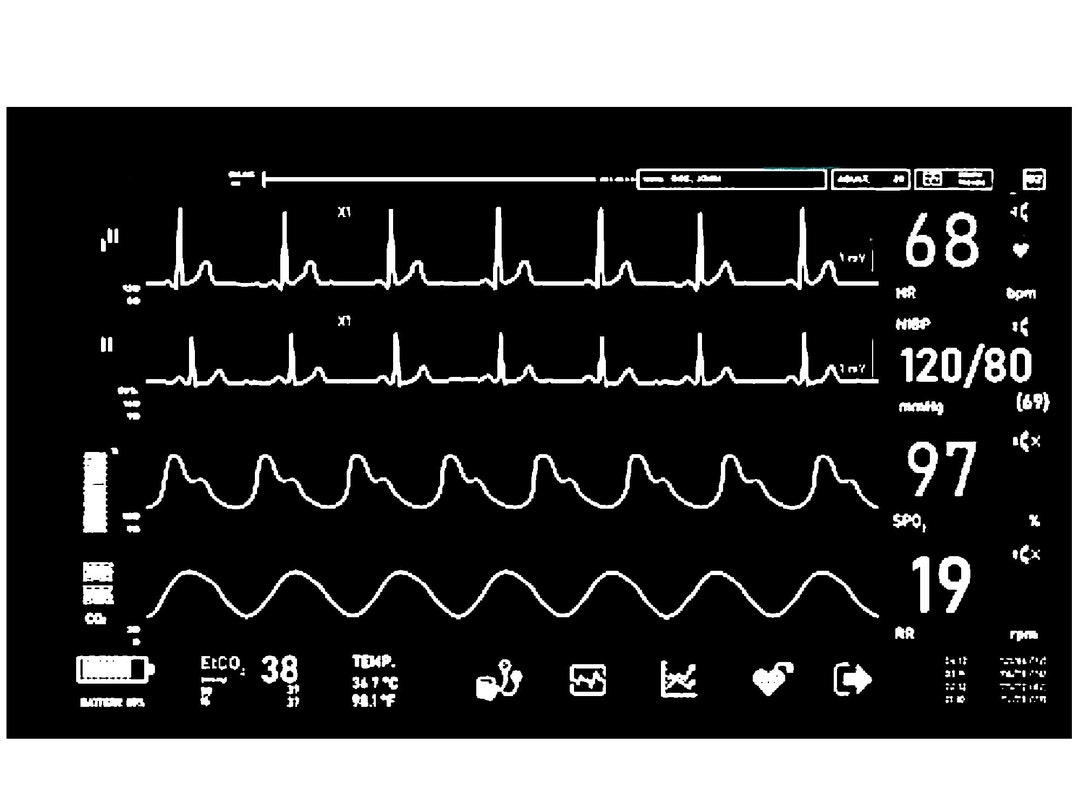 Cardiac Monitor SVG, PNG, and JPEG Included License Free! - Etsy