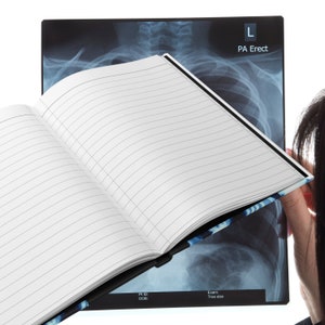Personalized Xray Tech Journal, Radiology Student Graduation Notebook ...