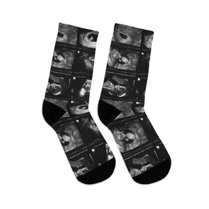 ULTRASOUND SOCKS, Sonographer Gift, Ultrasound Tech Graduation Gift ...