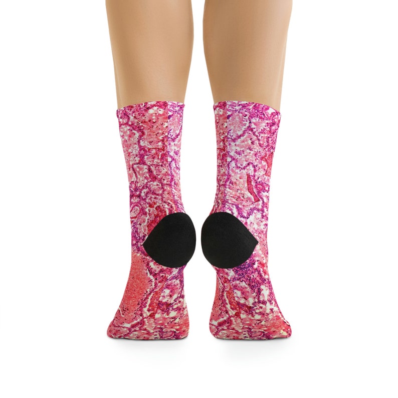 Lung Histology Socks Pathology Socks Histotech Socks - Etsy
