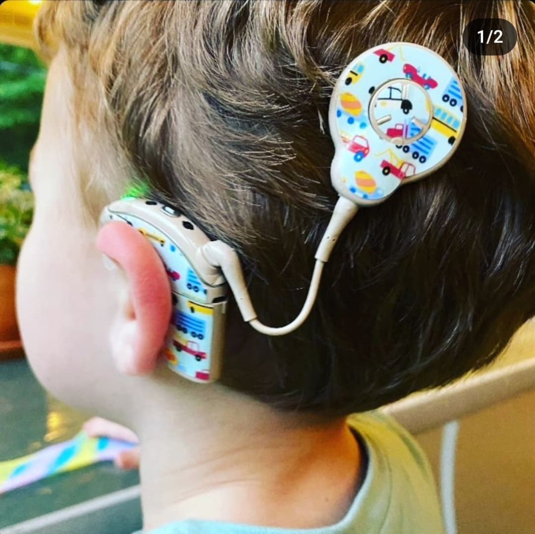 Custom Transportation: Skins for Medel, Cochlear, Advanced Bionics ...
