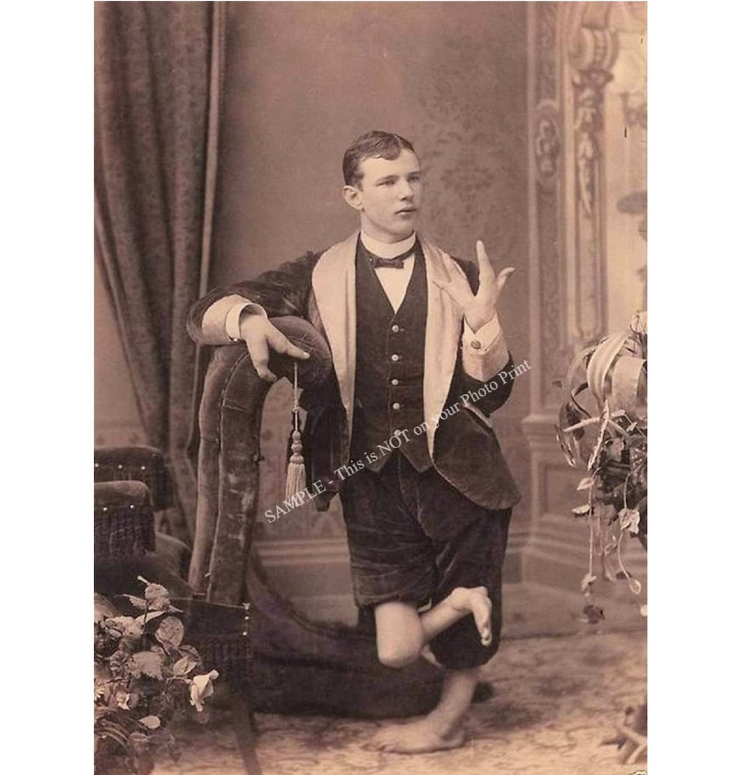 Creepy Lobster Boy Scary Sideshow Circus Act Freaky Child Strange Side ...