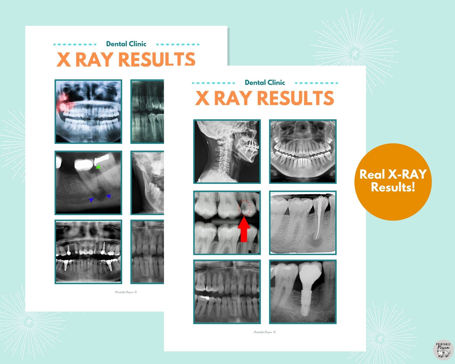 Dentist Pretend Play Set, Dental Clinic Play, Homeschool Activity ...