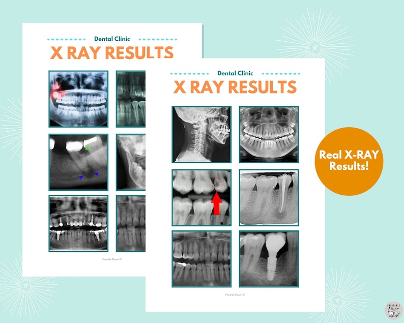 Dentist Pretend Play Set, Dental Clinic Play, Homeschool Activity ...