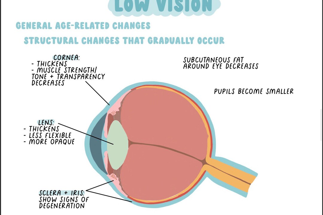 Low Vision Study Guide - Etsy