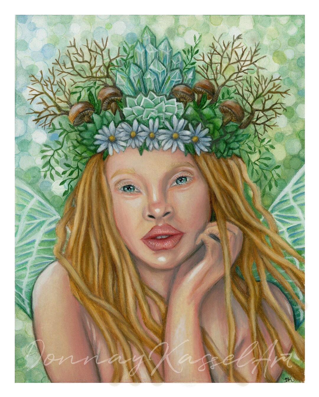 Fairy With Albinism- 8 by 10 Fine Art Print - Etsy