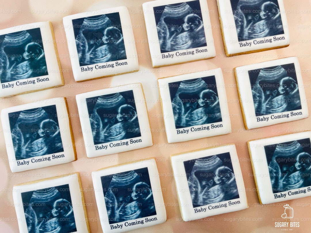 Baby Shower Cookies, Ultrasound Cookies, Edible Photo Cookies ...