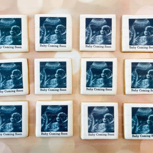 Baby Shower Cookies, Ultrasound Cookies, Edible Photo Cookies ...