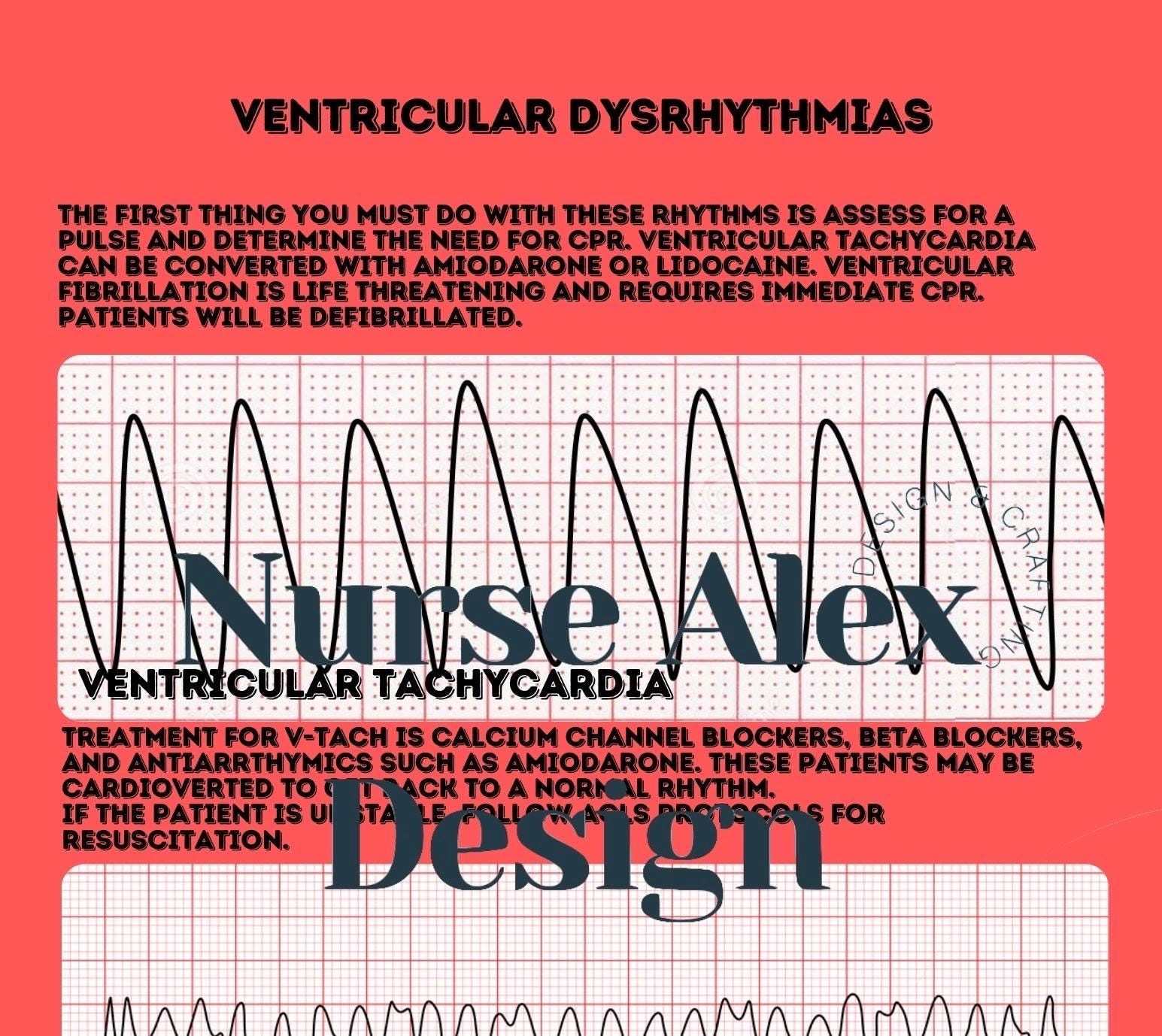Cardiac Rhythym Cheat Sheet - Etsy