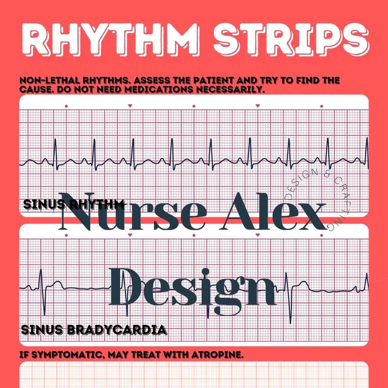 Cardiac Rhythym Cheat Sheet - Etsy