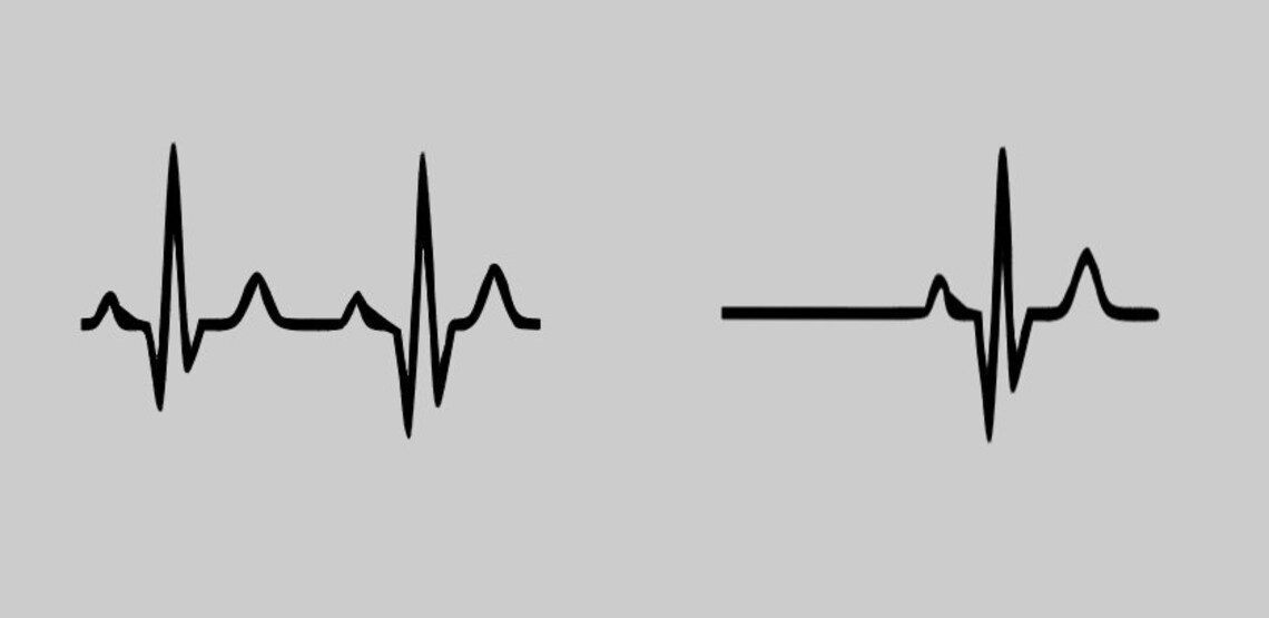 EKG Sticker for laptop MacBook/Apple/Windows/PC/Air/Pro/Heart | Etsy