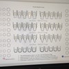 Acrylic Smile Line Practice Sheet DIGITAL DOWNLOAD - Etsy