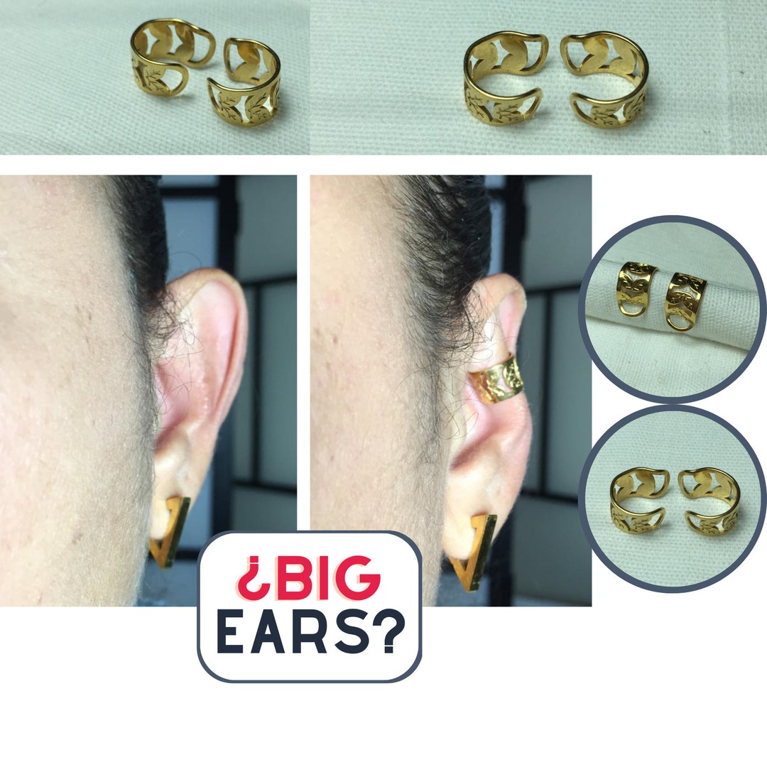 Corrector for Protruding Ears - Etsy