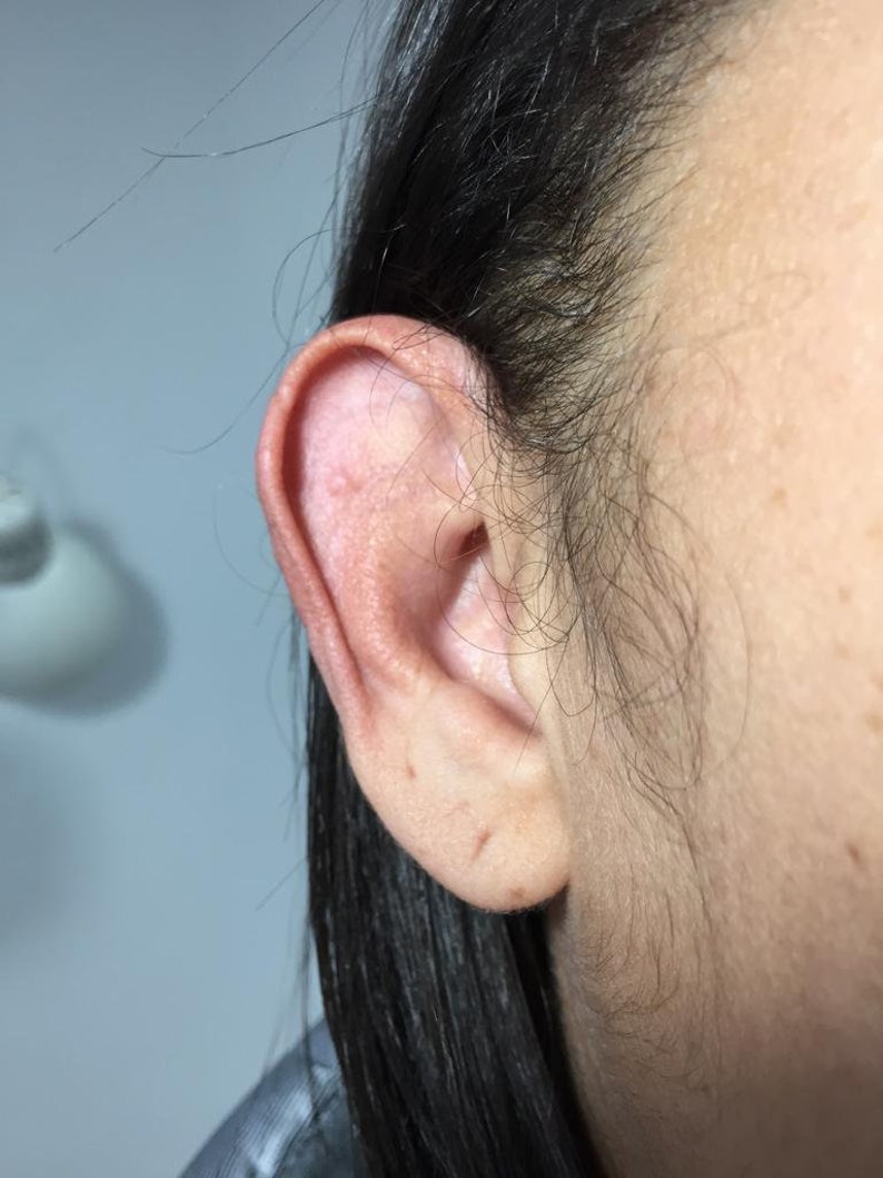 Big Ear Corrector aesthetic Ear Corrector - Etsy Hong Kong