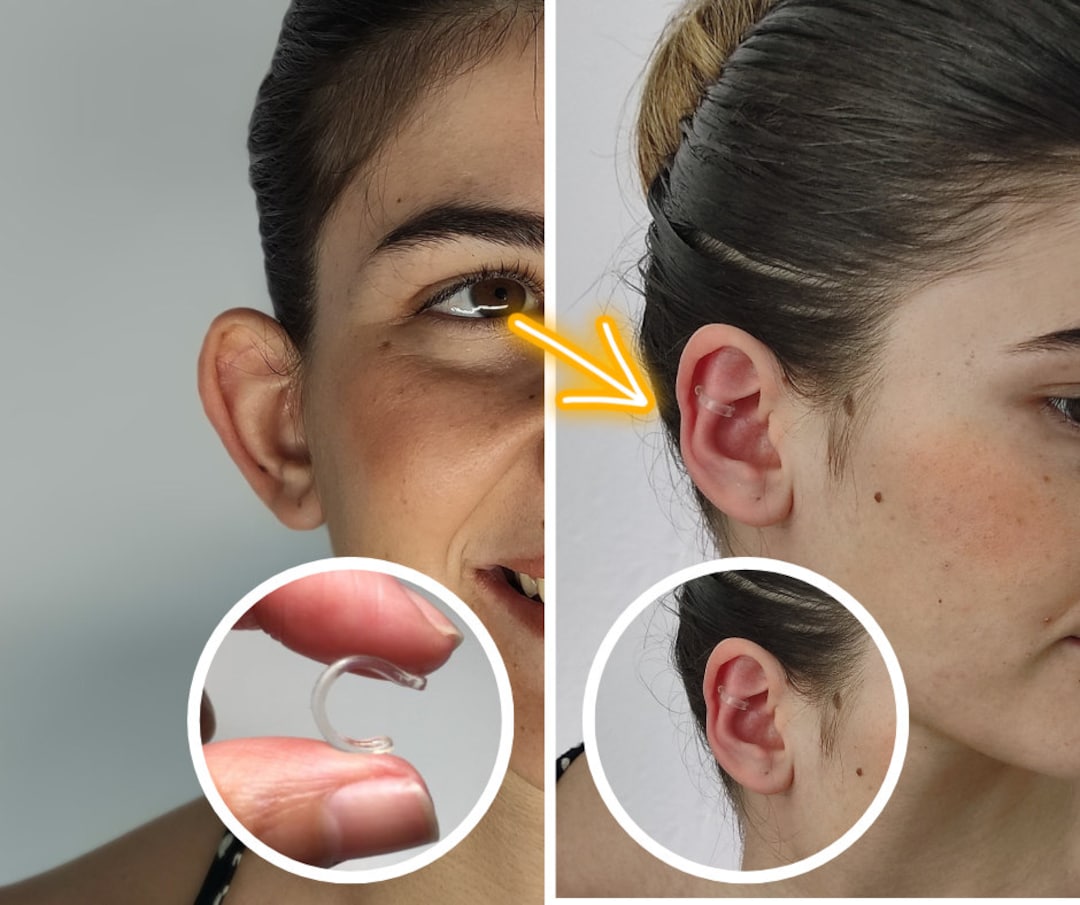 Protruding Ear Transparent Concealer Extrafine - Etsy