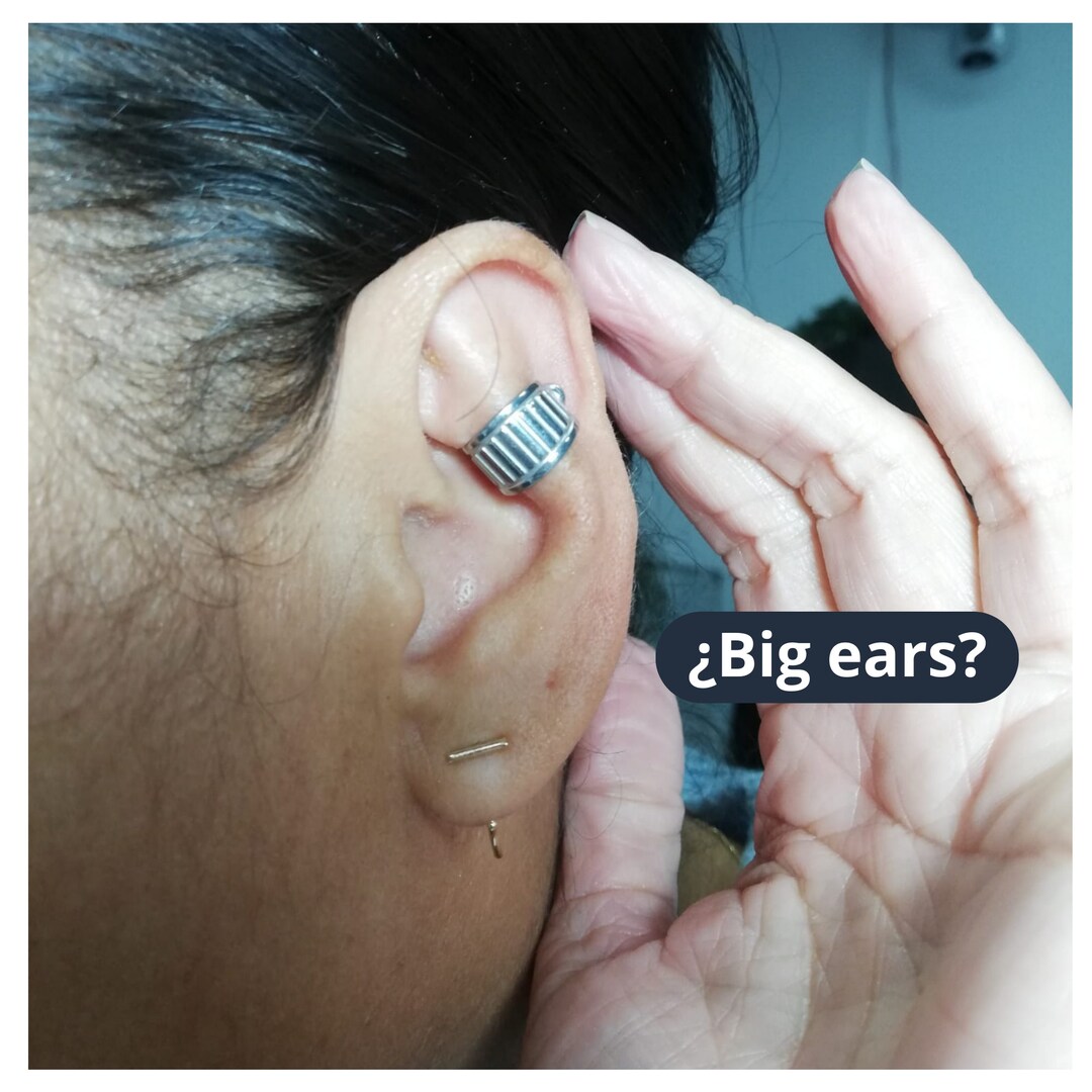 Big ear corrector corrector estético de orejas - Etsy México