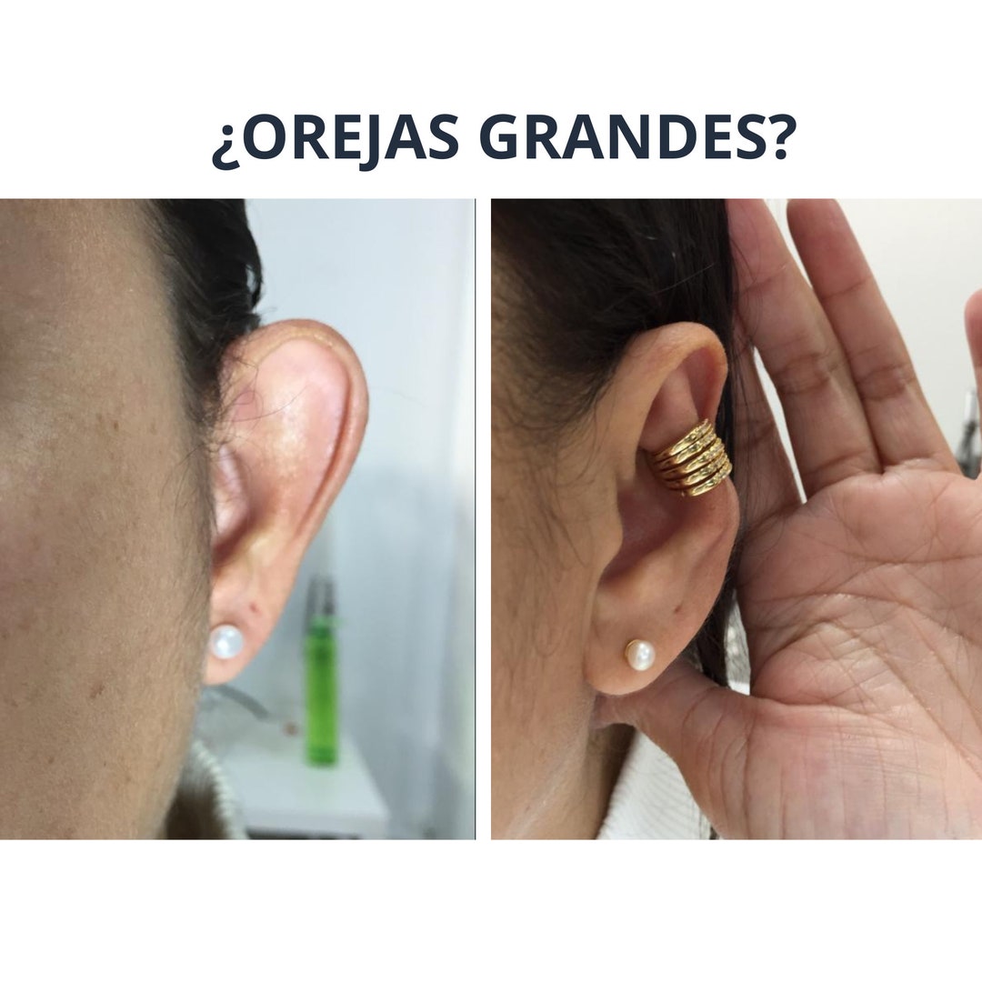 Big Ear Corrector aesthetic Ear Corrector - Etsy