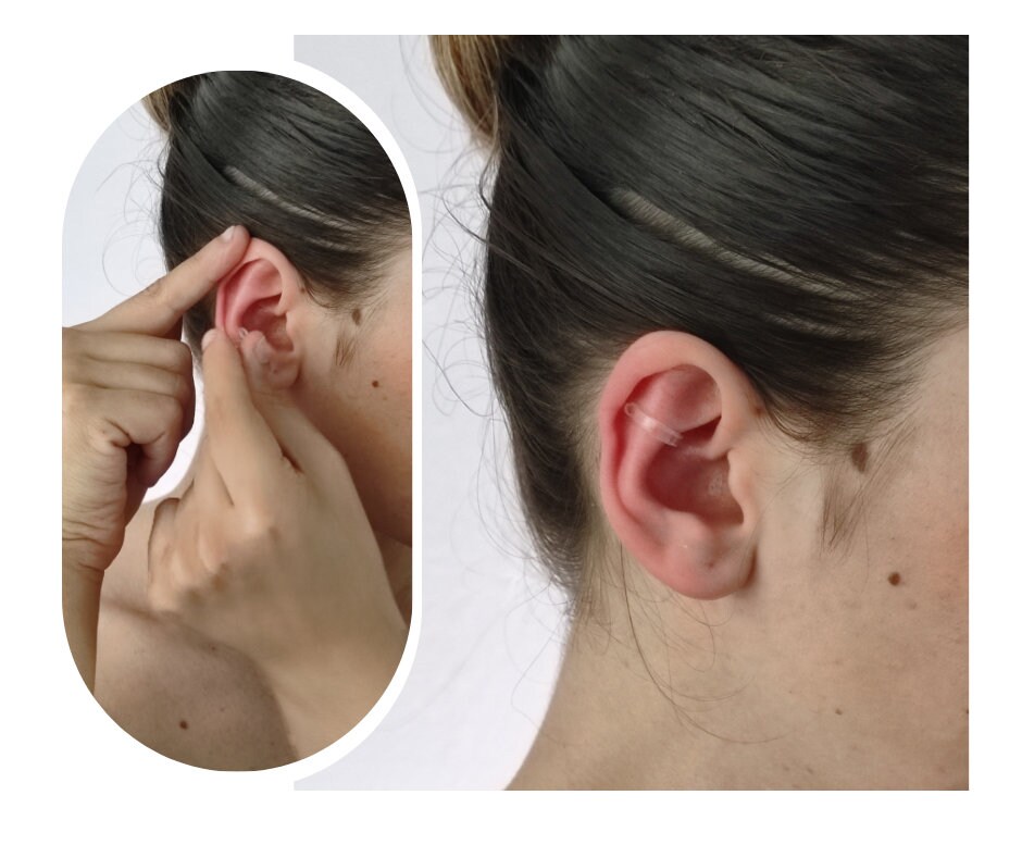 Protruding Ear, Look at This Extrafine Transparent Accessory, If Your ...