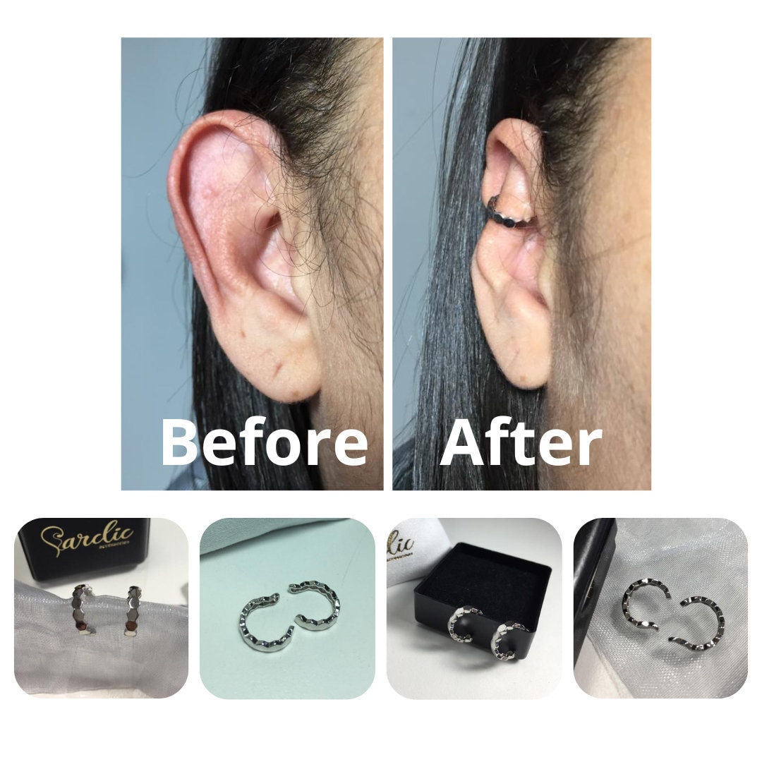 Earcuff for Prominent Ears - Etsy