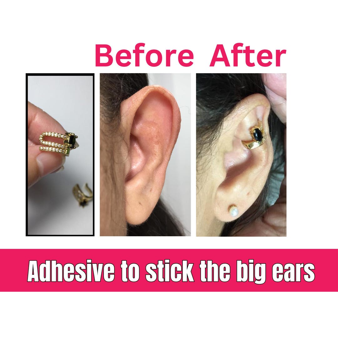 Earring for Big Ears/earcuff for Protruding Ears/ - Etsy