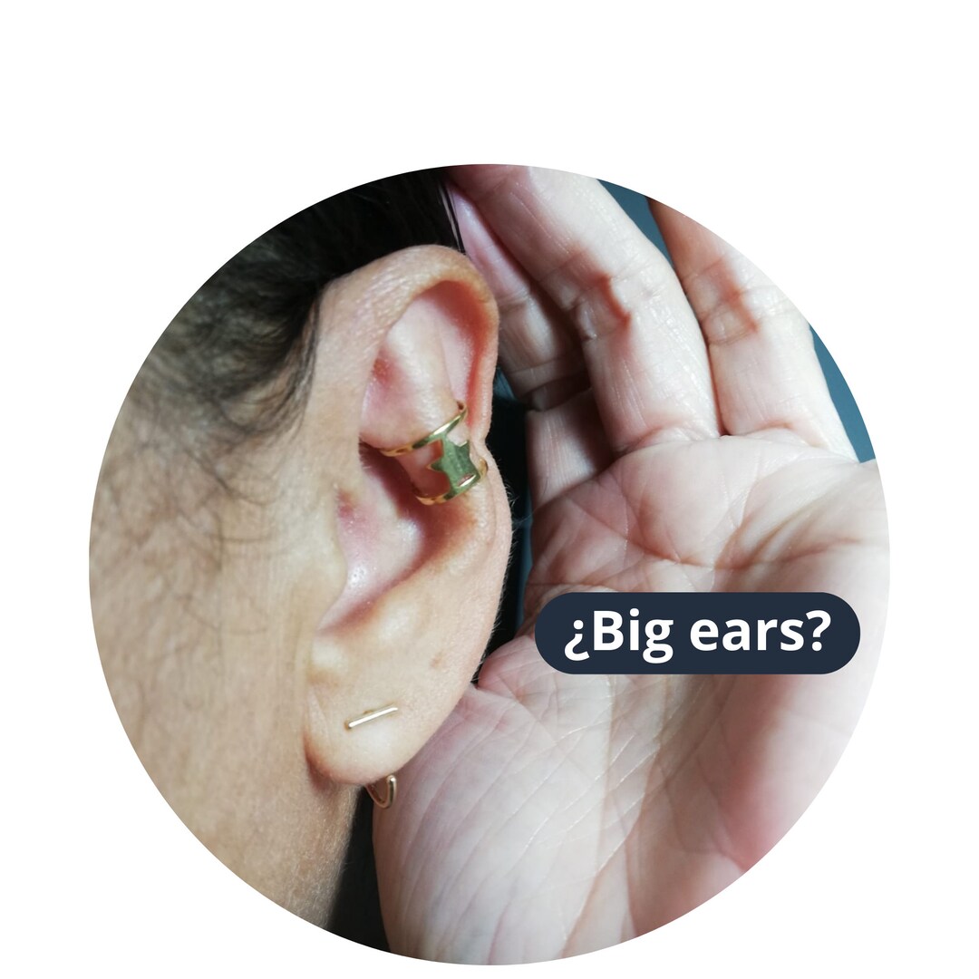 Big Ear Corrector aesthetic Ear Corrector - Etsy