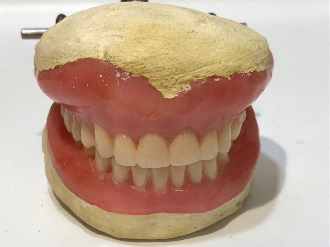 Collectible Vintage Plaster Dental Teeth Model in Brass Articulator - Etsy