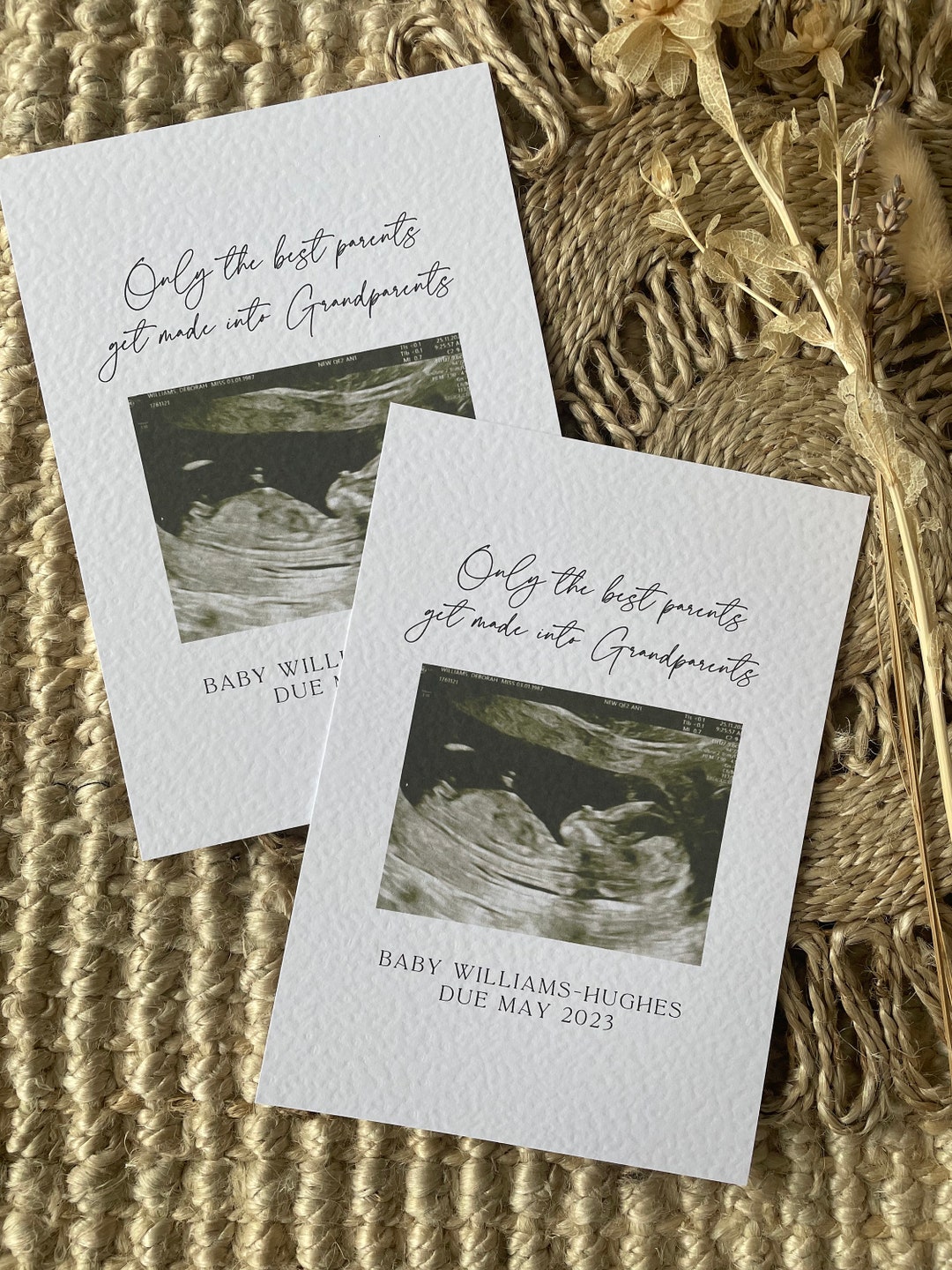 Personalised Custom Baby Scan Announcement Cards, Baby Announcement ...