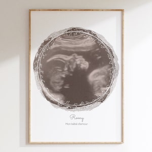 Personalised Baby Scan Print: Ultrasound Photo Keepsake - Etsy UK