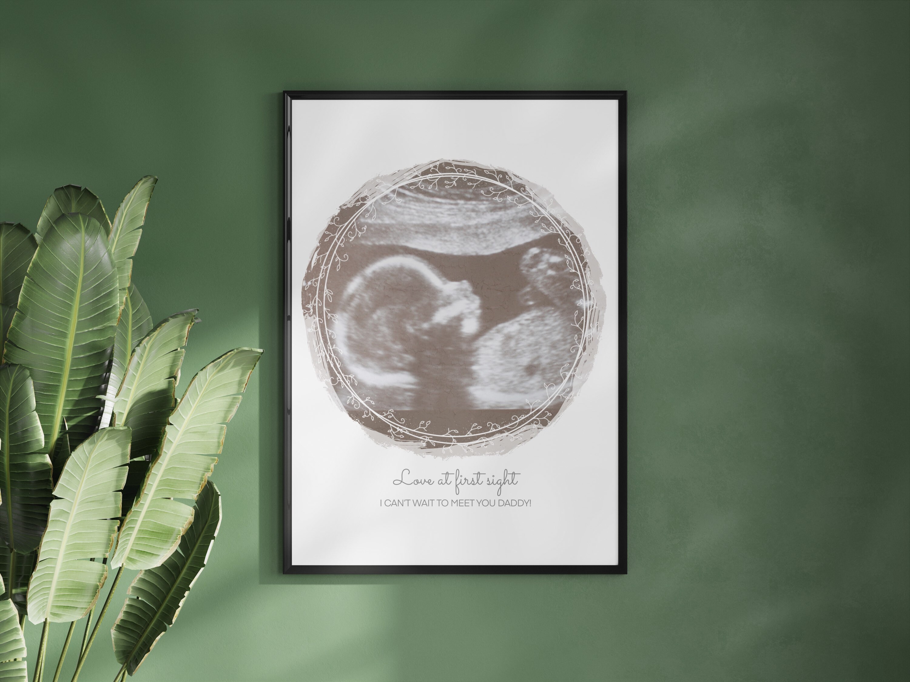 Baby Scan Print Ultrasound Photo Pregnancy Announcement | Etsy