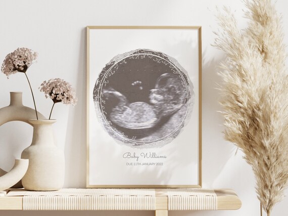 Baby Scan Print Ultrasound Photo Pregnancy Announcement | Etsy
