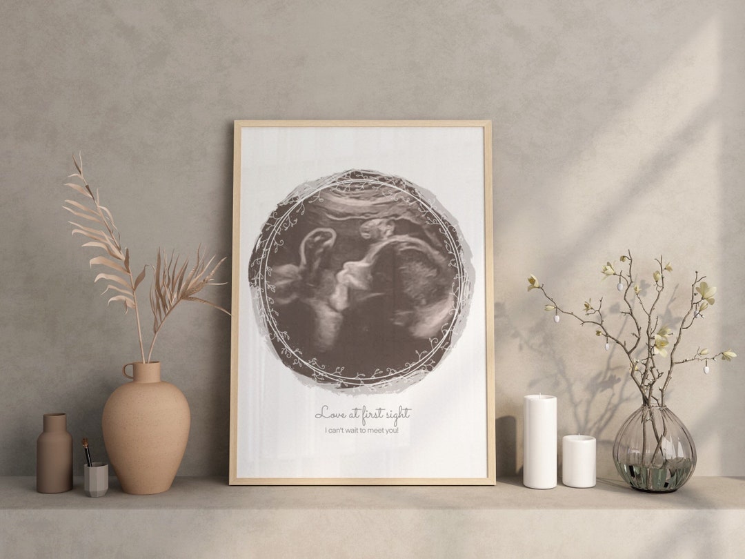 Personalised Baby Scan Print: Ultrasound Photo Keepsake - Etsy UK