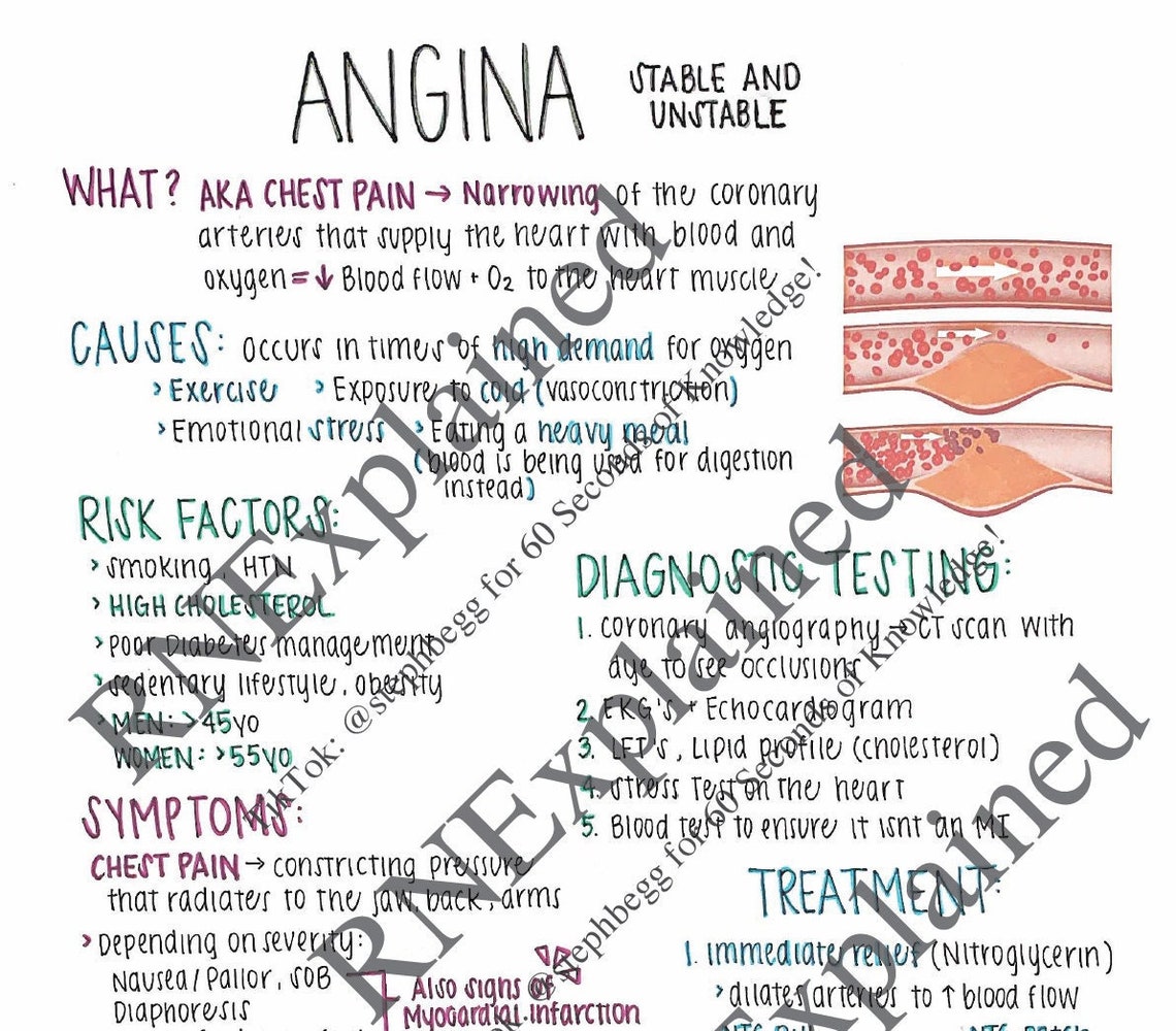 Stable/unstable Angina nursing Study Sheets | Etsy