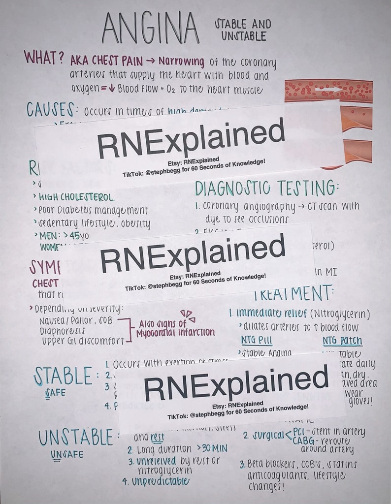 Stable/Unstable Angina Nursing Study Sheets | Etsy