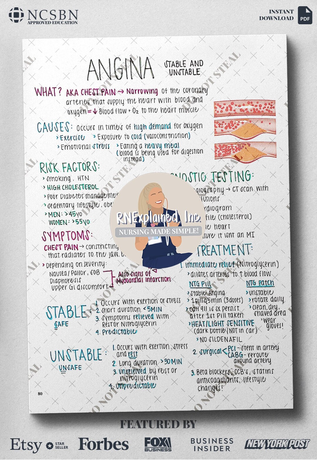 Stable/unstable Angina nursing Study Sheets - Etsy