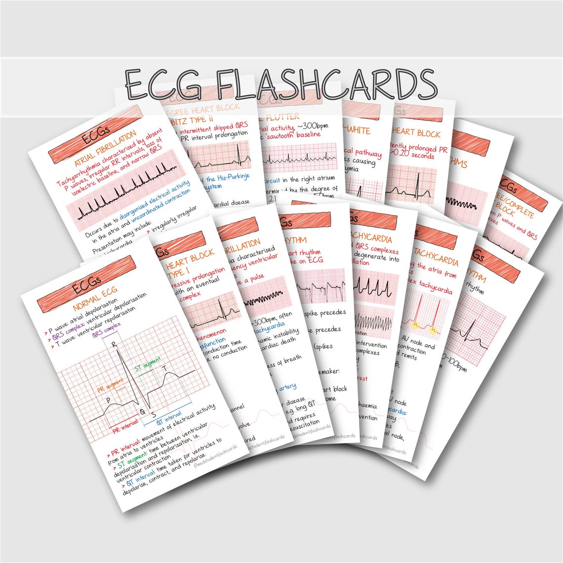 ECG Rhythms Flashcards PDF - Etsy