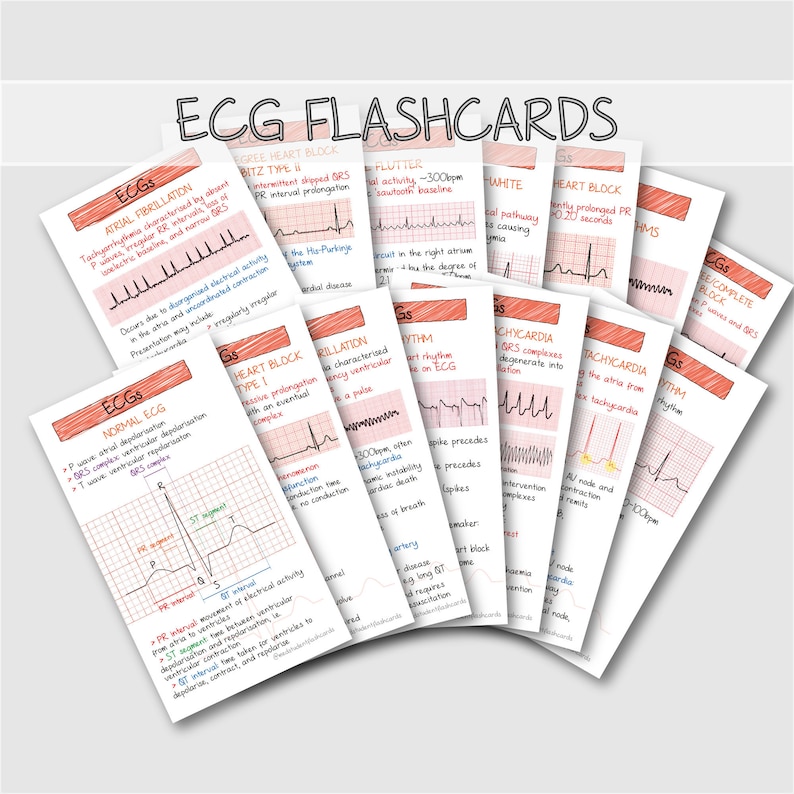 ECG Rhythms Flashcards PDF - Etsy