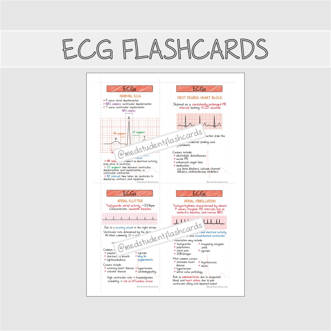 ECG Rhythms Flashcards PDF - Etsy