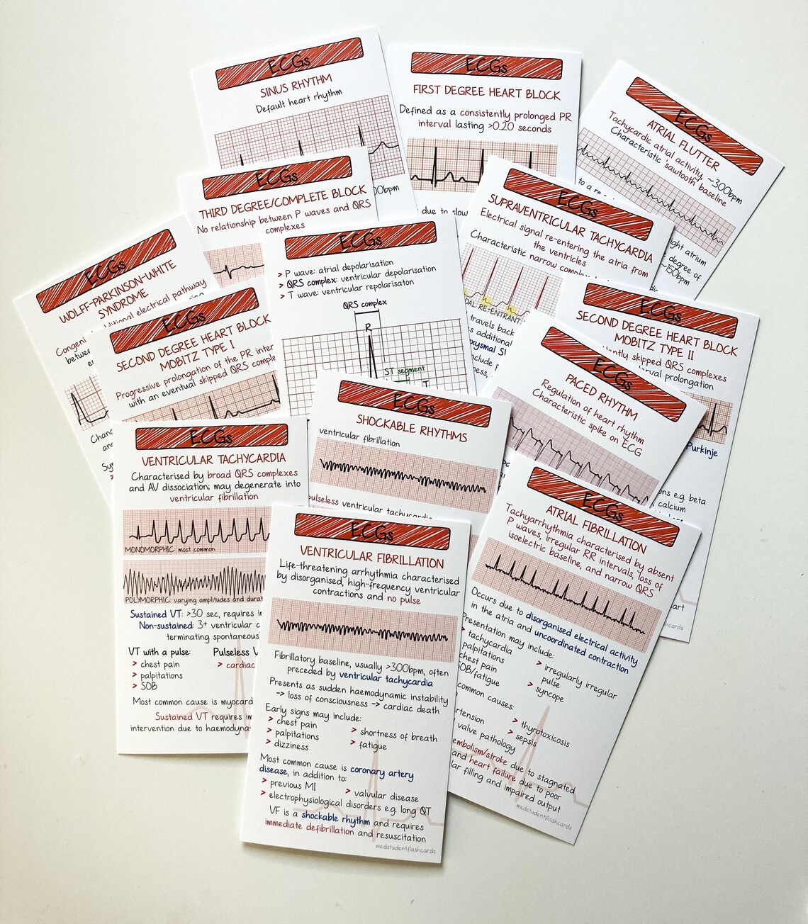 ECG Rhythms Flashcards - Etsy