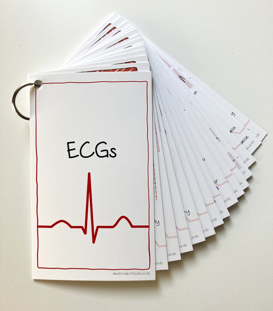 ECG Rhythms Flashcards - Etsy