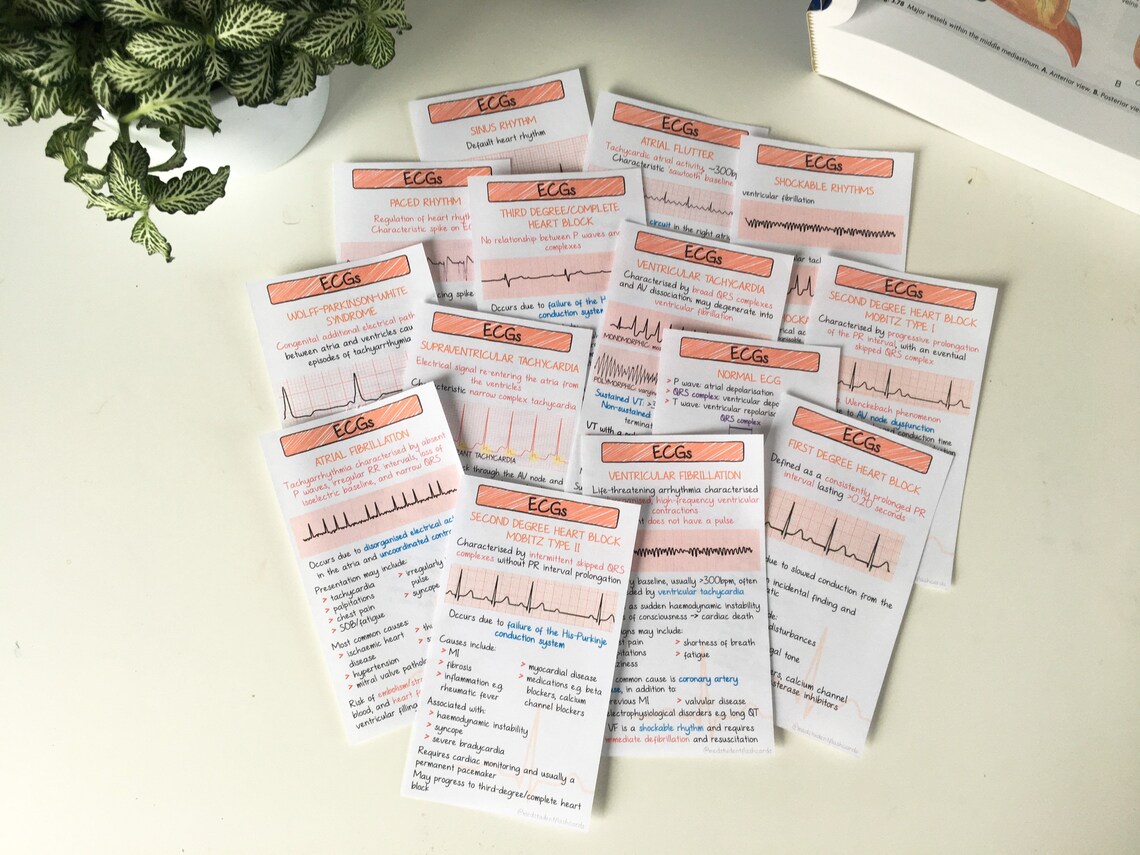 ECG Rhythms Flashcards PDF - Etsy