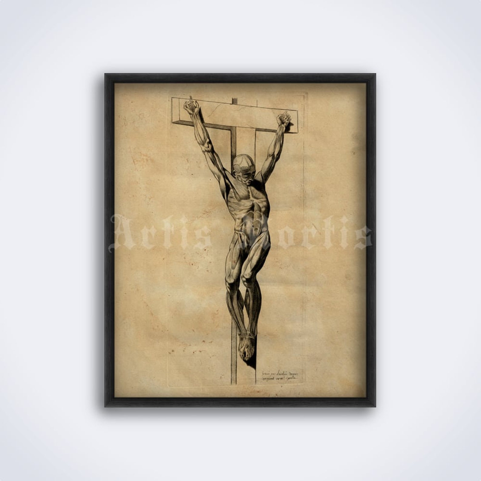Crucified Human Body, Creepy Scary Corpse – Vintage Medical Art Print ...